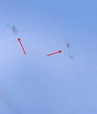 ¿Qué son las manchas negras que vemos moviéndose en los ojos? | Ideal