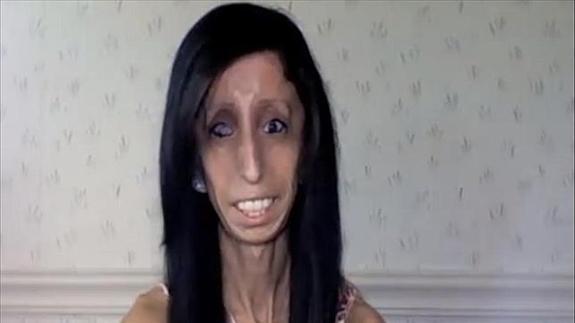 La llamada 'mujer más fea del mundo' alerta contra los memes | Ideal